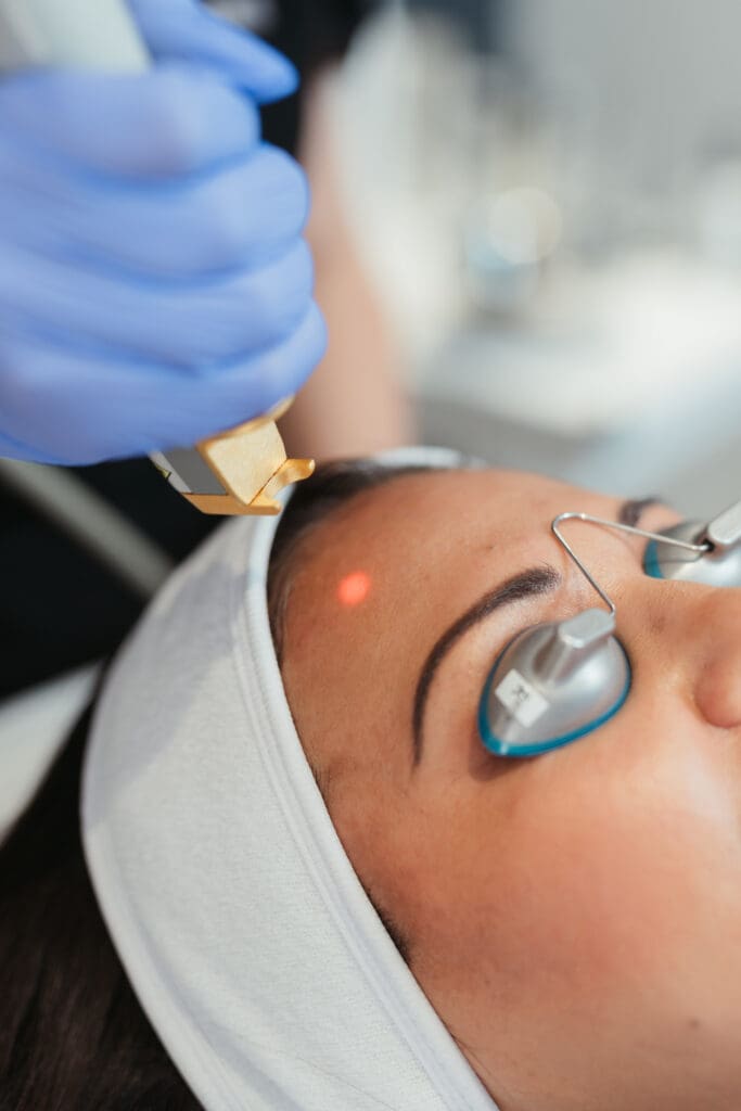 Laser Genesis for Skin Tone | Derma Health