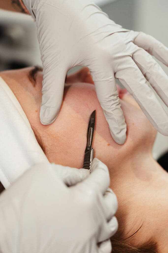 Epiblading / Dermaplaning | Derma Health