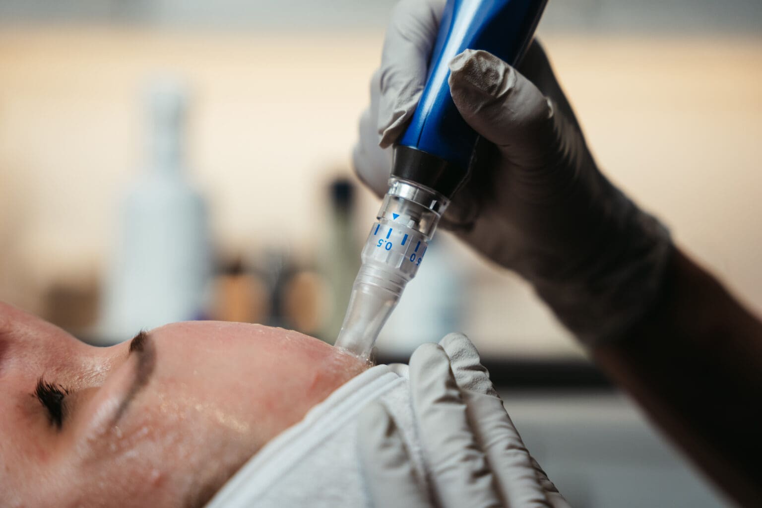 Microneedling & Plasma Pen | Derma Health