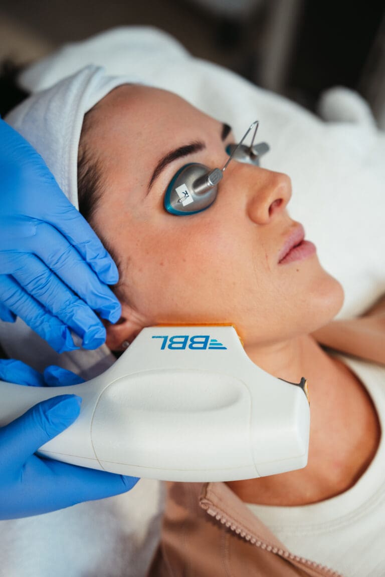 Broadband Light | Derma Health