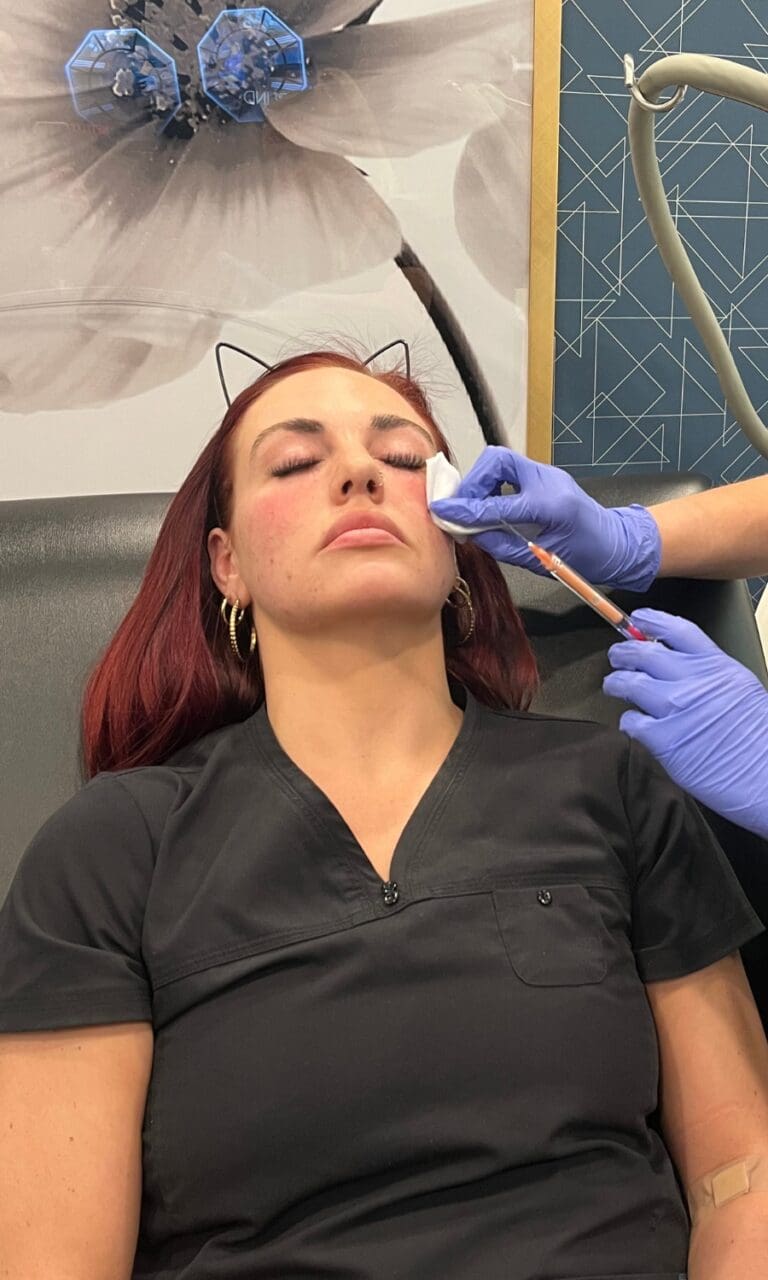 PRF (Platelet Rich Fibrin) | Derma Health